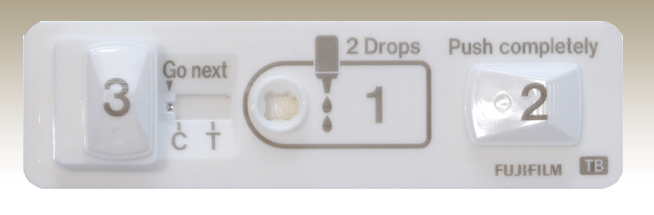 Fujifilm SILVAMP TB LAM – PHRI